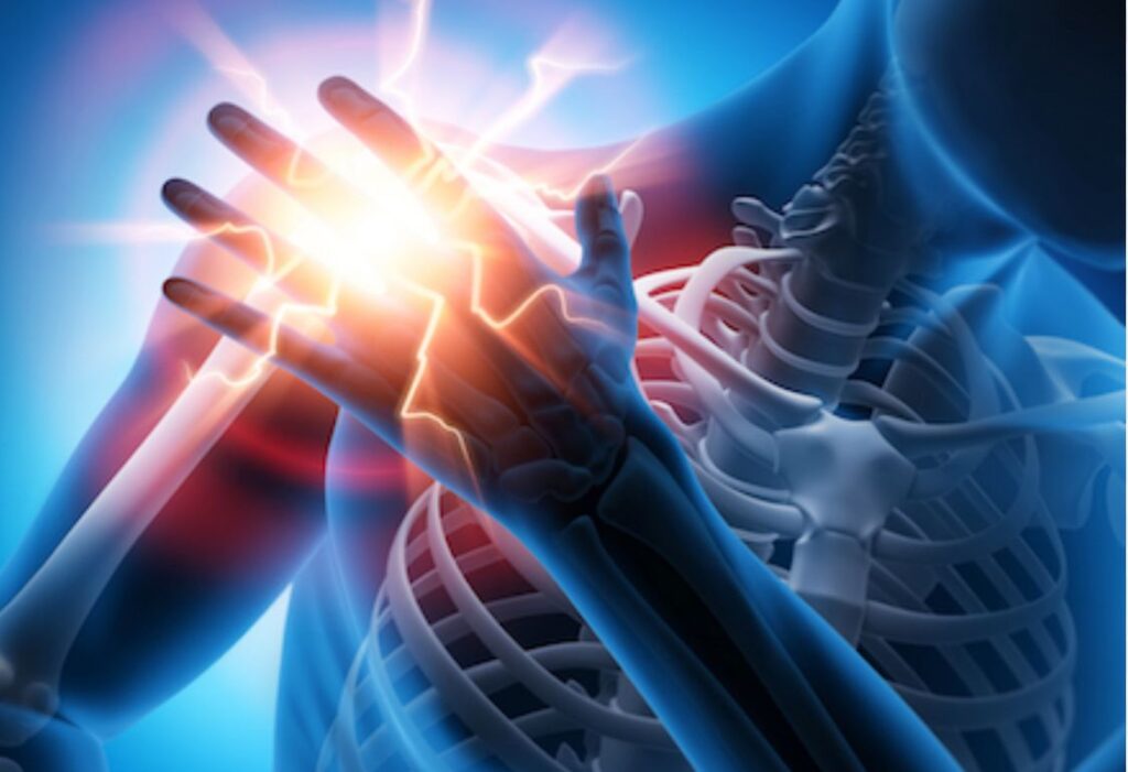 Breaking the Ice: Recovery for a Frozen Shoulder - Atlas Chiropractic ...